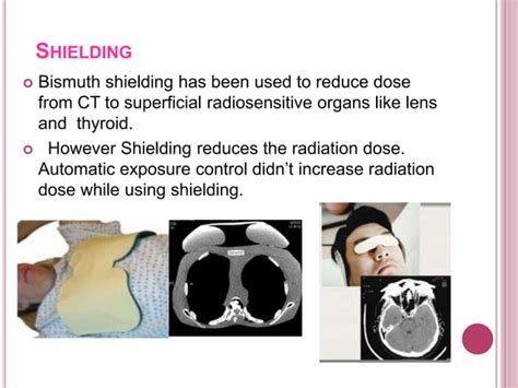 Ct Radiation Dose Reduction Ppt