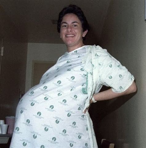 Woman Gives Birth To Identical Triplets Who Become Ob Gyn Doctors Just
