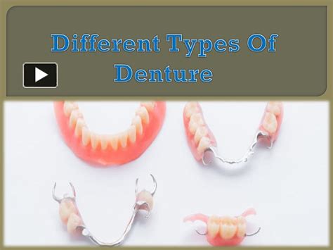 Different Types Of Denture Presentation Free To Download