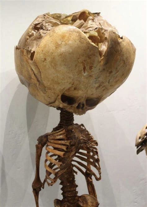This Skeleton Rtrypophilia