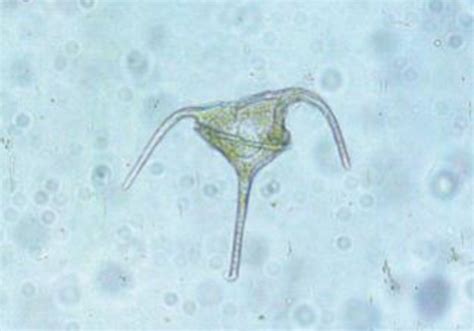 Dinoflagellates Microscope Slide