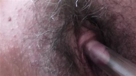 Detailed Professional Technology Of Exposing And Enlarging The Clitoris Eporner