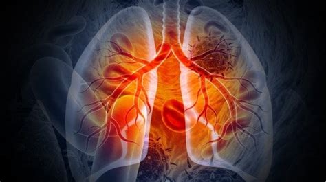 Esmo Abstract Leak Reveals Promising Nsclc Therapies From Bms Beigene Jandj Mirati R