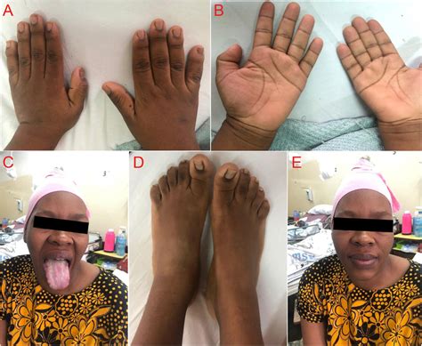 Spade With Teeth At Frank Duke Blog