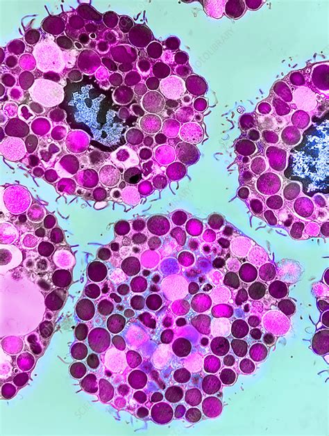 Mast Cell Tem Stock Image C0610584 Science Photo Library