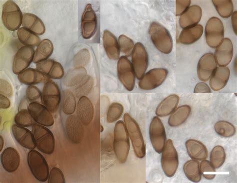 Endococcus Verrucosus Le 264379 In Water A Variety Of Shapes And