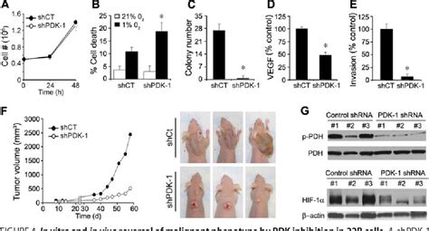 Figure 4 From Pyruvate Dehydrogenase Complex Activity Controls Metabolic And Malignant Phenotype