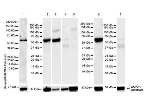 Protein Ladder For Western Blot Asiakool