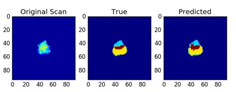 Segmenting Overlapping Chromosomes Using Deep Learning Iota