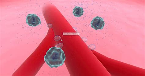 Premium Photo Anaphylaxis Histamine Release And Vascular Edema