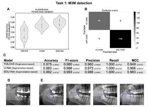 Overall Results Of Model Performance For The Mandibular Third Molar Download Scientific Diagram