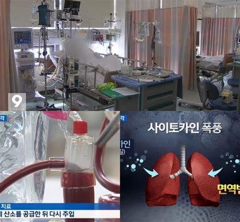 삼성서울병원 4차 감염자 다수 접촉 메르스 재확산 우려 심각 메르스