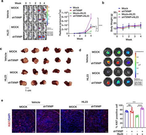 Thioredoxin Interacting Protein Activated Intracellular Potassium Deprivation Mediates The Anti