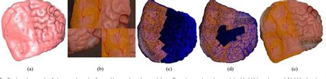 Figure 5 From Endoscopic Video Texture Mapping On Pre Built 3 D