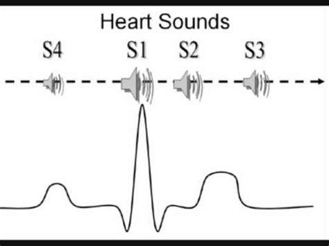What Is S3 Sound Cardiovascular Auscultation Third And Fourth Heart