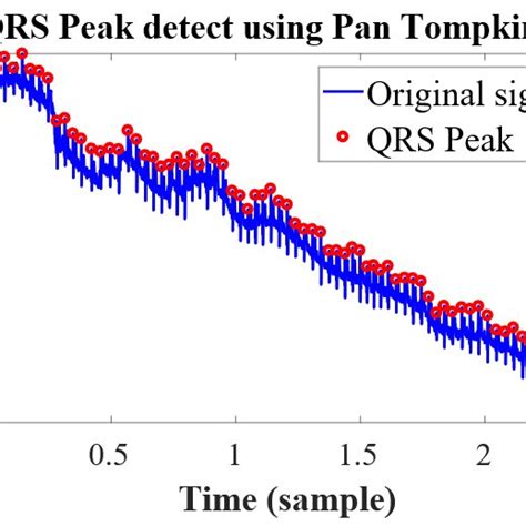 Qrs Detection Of Ecg Signal Using The Pan Tompkins Algorithm Download Scientific Diagram