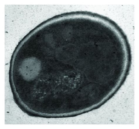 TEM Observations On C Albicans Cells Treated Alone Or In Combination