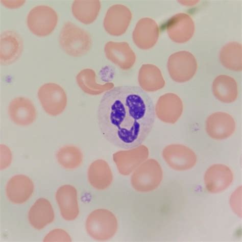 Segmented Neutrophils Identification And Differentiation