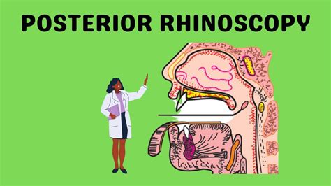 Posterior Rhinoscopy Youtube
