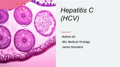 Hepatitis C Hcvpptx