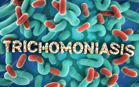 Premium Ai Image Trichomoniasis
