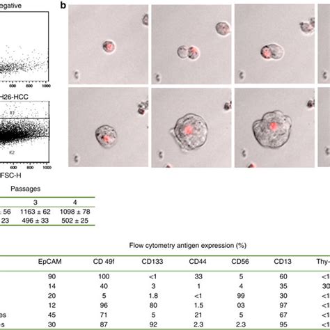 Development Of An Orthotopic Hcc Model A 105 Human Hcc Cells Were