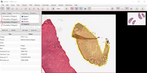 Annotating And Making Measurements Qupath Embo 2021