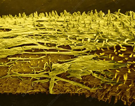 Bean Root SEM Stock Image C028 3671 Science Photo Library