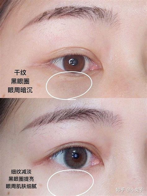 长期熬夜黑眼圈很重怎么办？ 知乎