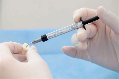 Trusfil Flow Flowable Composite Restorative Resin Huge Dental