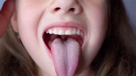Girl Opens Her Mouth Wide Pulls Stock Footage Video 100 Royalty Free