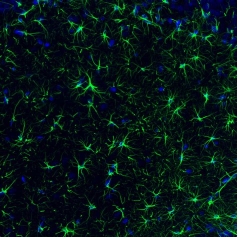 Mouse Monoclonal Anti Gfap Antibody Buy For Research Highly