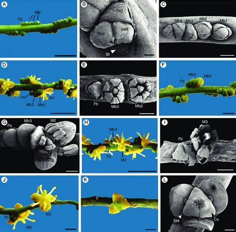 Sem And Macroscopic Views Of The Developing Acervulus In Gaussia