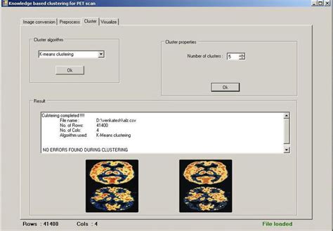 are the segmenting results on a synthetic image using k means