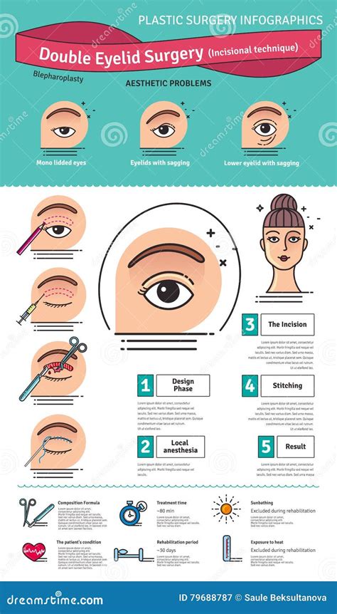 Vector Illustrated Set With Double Eyelid Surgery Stock Illustration