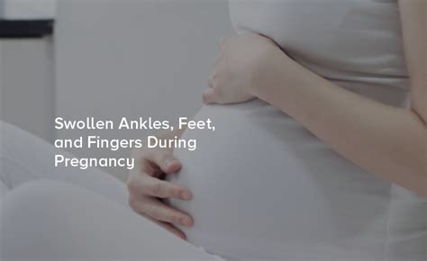 Swollen Ankles Feet And Fingers During Pregnancy Causes Prevention