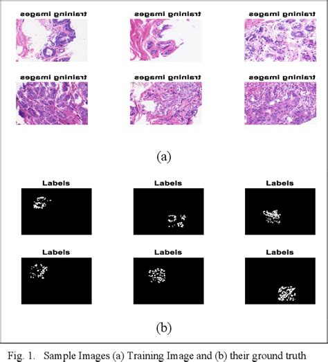 Figure 1 From Breast Cancer Cell Segmentation Using Attention Based Deep Neural Network