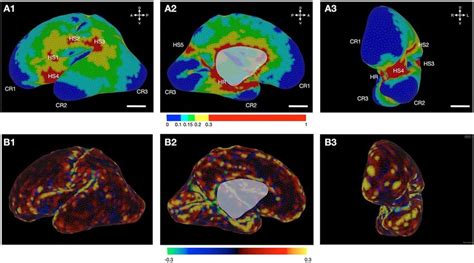 association of geodesic distribution with cortical surface geometry