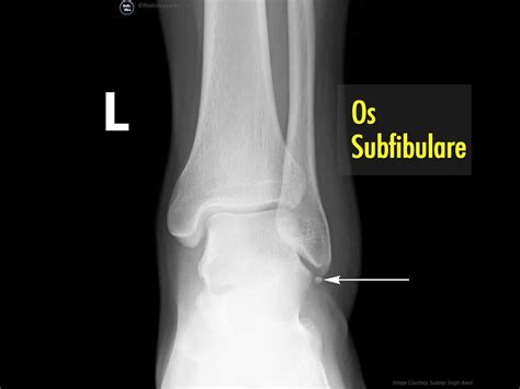 Radiology Vibes Online Learning Platform For Radiologists