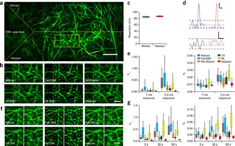 Hessian Sim Excels In Resolving Densely Packed Cellular Actin