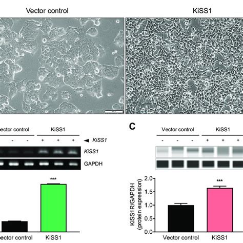 Kiss1 Overexpression And Characterization Hepg2 Vector Control Cells