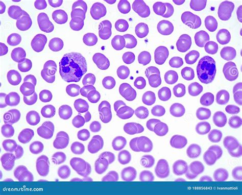 Two Segmented Neutrophil Granulocytes In A Blood Smear Under The