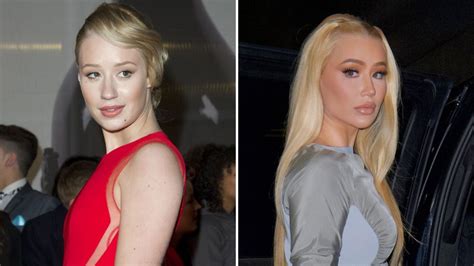Iggy Azalea Plastic Surgery Transformation Photos Quotes Life And Style