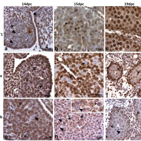 Dnmt Dnmt A And Dnmt B Labelling In Male Rat Embryonic Gonads Dnmt