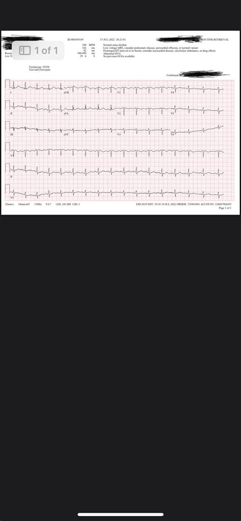 Prolonged Qtc Does This Ekg Actually Show 490 Qtc R Askcardiology