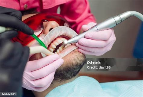 전문 치아 청소 치과 의사는 남성 환자의 치아를 청소합니다 건강관리와 의술에 대한 스톡 사진 및 기타 이미지 건강관리와 의술 남성 남자 Istock