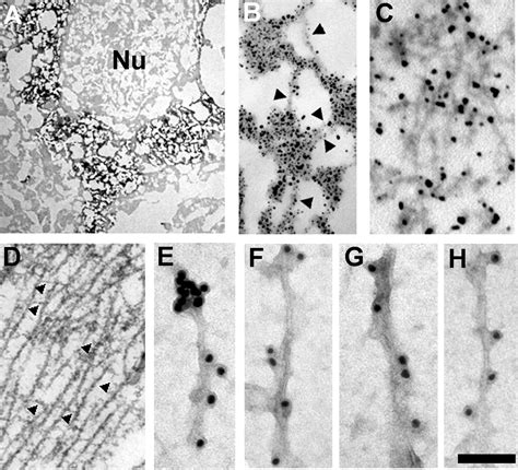 Neuronal α Synucleinopathy with Severe Movement Disorder in Mice