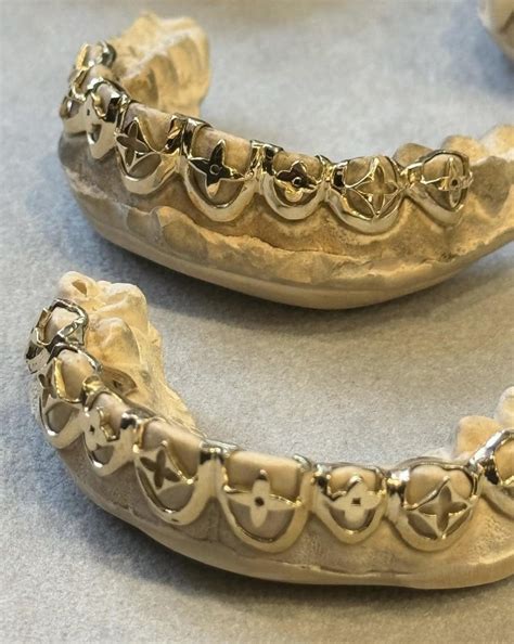 Grillz At Pharrells Lv Fw24 Show Rcamronspinkfurcoat