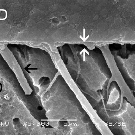 Representative Sem Image Of The Resin Dentin Interface From The Control