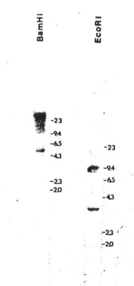 Dna Blot Hybridization Of 32p Labeled Lts 1 Dna To Ecorl And Bemhl